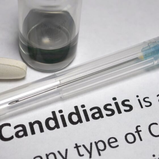 Candidose intestinale : protocole naturel et efficace